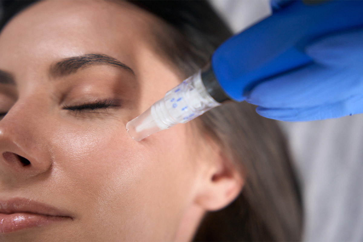 SkinPen Microneedling - Blush Med Spa CT